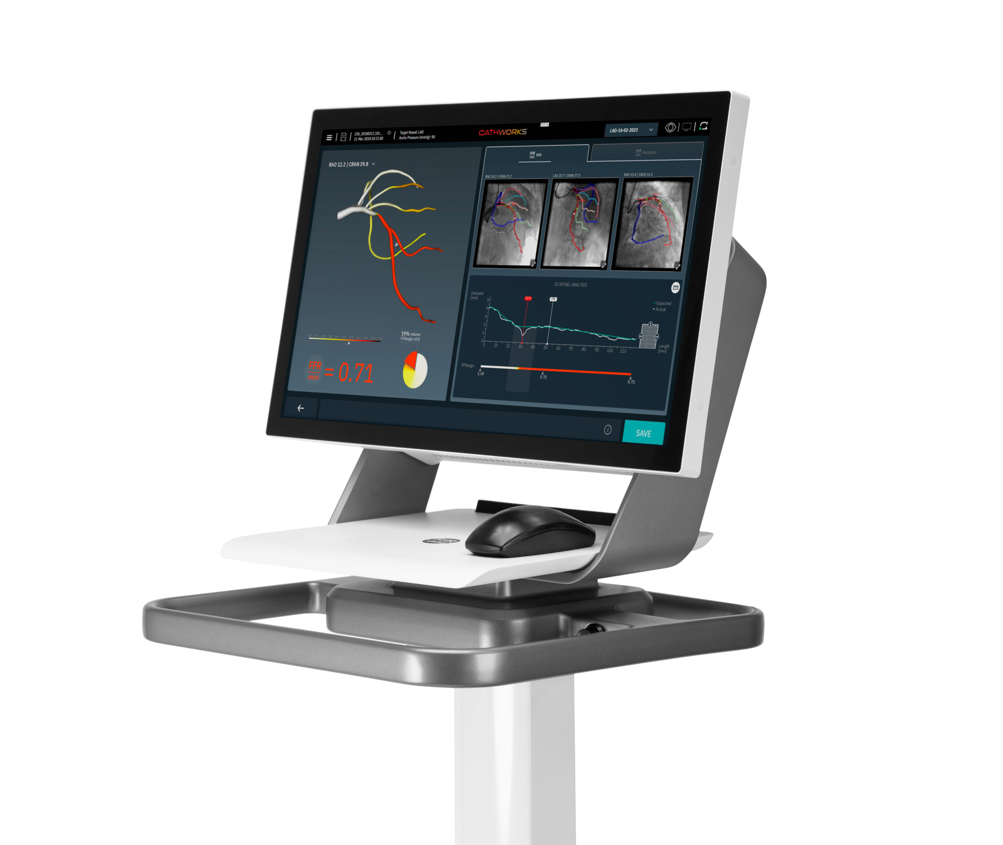 CIS & Terrebonne General Introduce CathWorks FFRangio® in LA